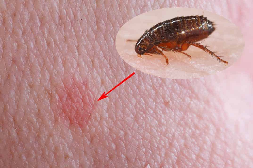 Early Warning Signs of Flea Infestations and How to Spot Them | Wake Pest